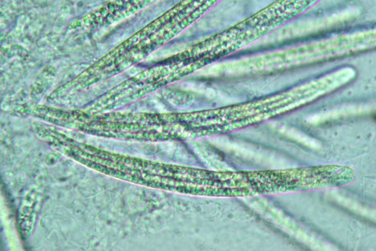 Gaeumannomyces graminis